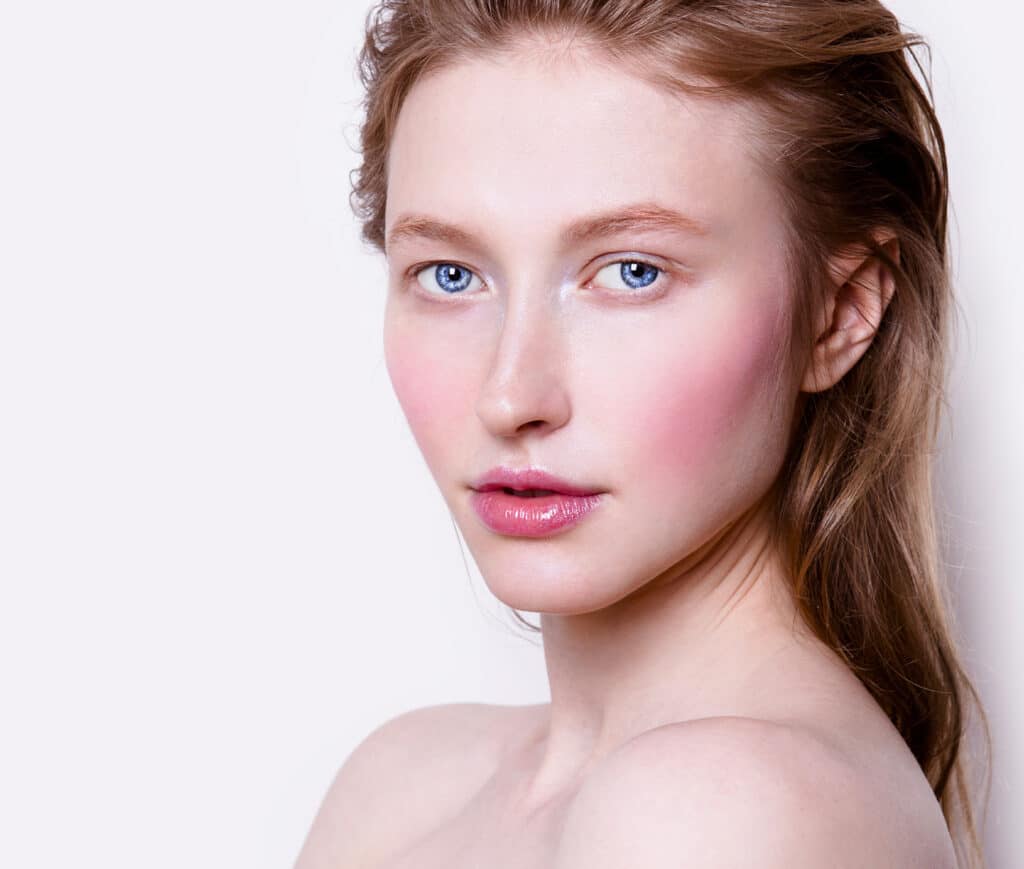 Rosacea : Causes and Treatments | Skin Marceau Clinic | Paris